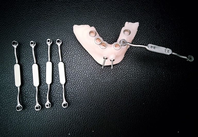 Implant Surgical Guides - IDDS 3D Printing